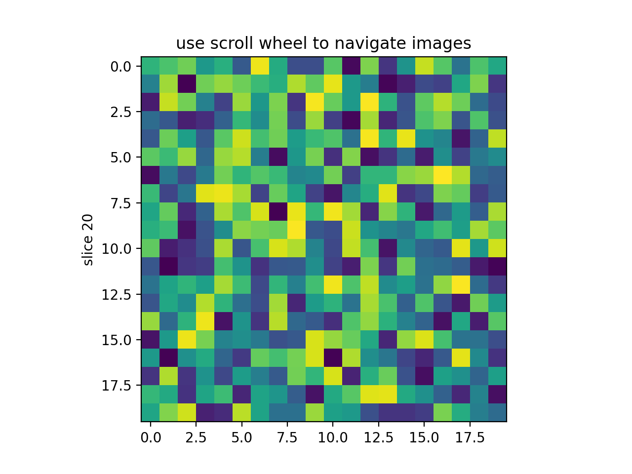 Visionneuse de tranches d'image_Matplotlib —— Python visualisation
